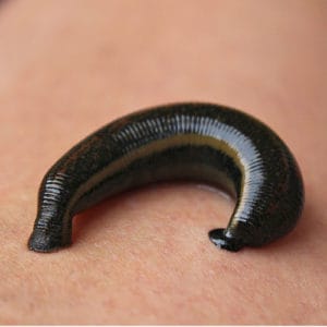How to Get Rid of Leeches in Ponds (Quick & Safe Treatments) - Pond ...
