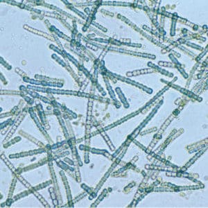 7 Types of Bacteria & Microorganisms In Pond Water - Pond Informer