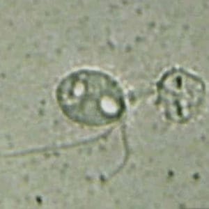 Costia (Ichthyobodo) Koi Treatment (6 Steps) - Pond Informer