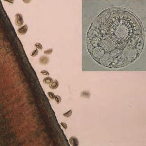 Koi Trichodina Treatment Guide (5 Steps) - Pond Informer